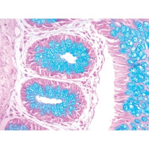 Alcian Blue pH 2.5 Stain Kit | Cancer Diagnostics Inc.