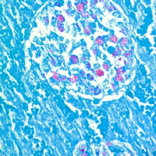 Acid Fast Bacteria (Kinyoun) Stain Kit, 500mL | Cancer Diagnostics Inc.