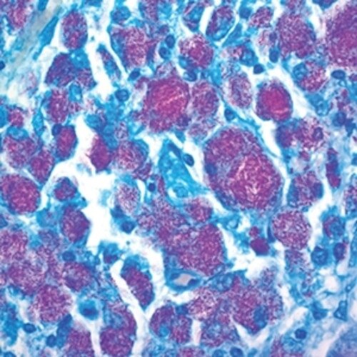 Fite Stain Kit, Leprosy, 250mL | Cancer Diagnostics Inc.