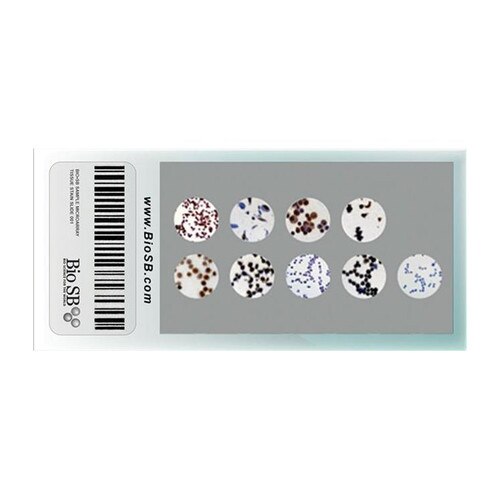 Varicella Zoster Virus Cell Line Array (2 Core) | Cancer Diagnostics Inc.