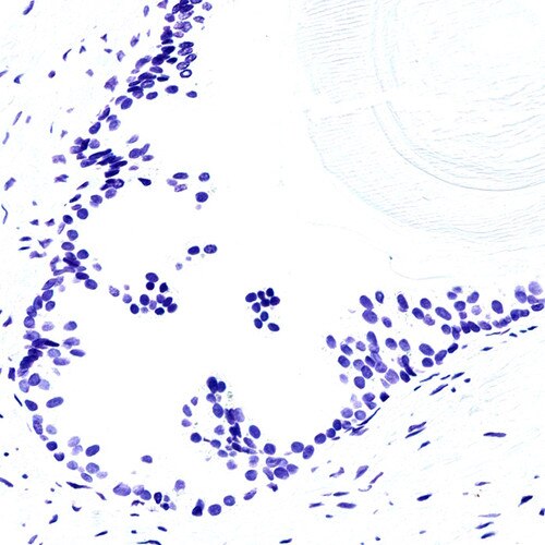 Blue Feulgen DNA Ploidy Analysis Staining Kit | Cancer Diagnostics Inc.