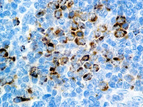 Granzyme B -RPab | Cancer Diagnostics Inc.