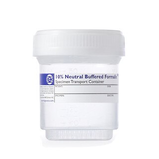 formaldehyde specimen jar